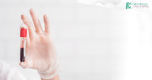 Does Skin Cancer Show Up In Blood Work? - Dermatology of Seattle & Bellevue